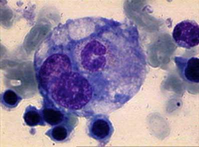 Macrofagen: kenmerken, training, typen, functies - Maestrovirtuale.com