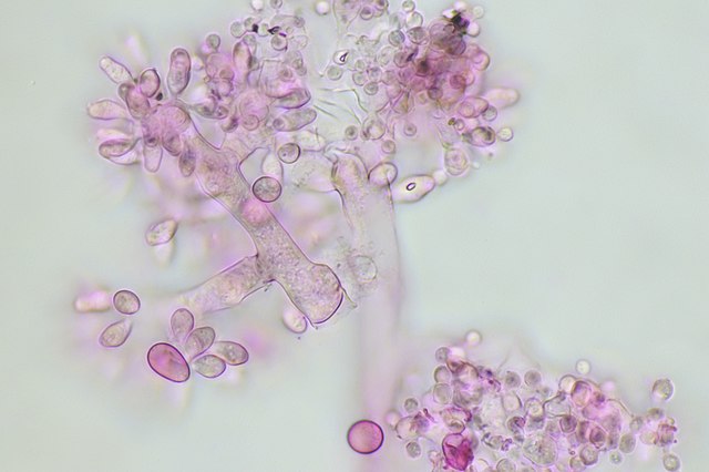 Botrytis: características, tipos, sintomas, controle - Maestrovirtuale.com